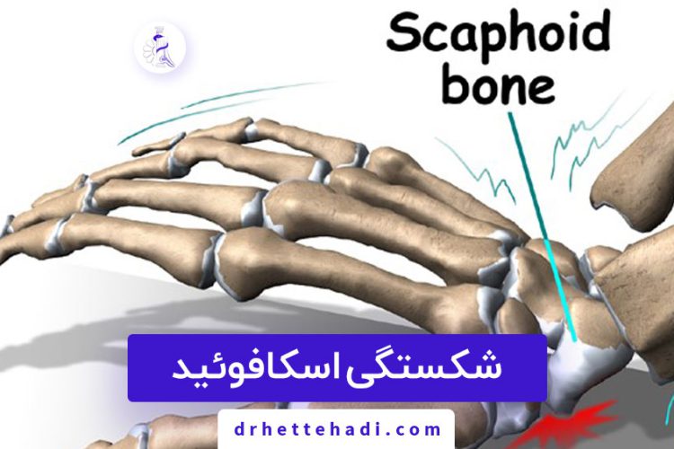 10 ورزش برای انگشتان دست | دکتر حسین اتحادی